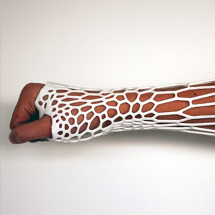 3D-Printed Prosthesis: Custom Casts & Artificial Limb Covers | Urbanist