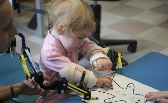 Touchable Memories: 12 3D-Printed Aids for the Disabled - WebUrbanist