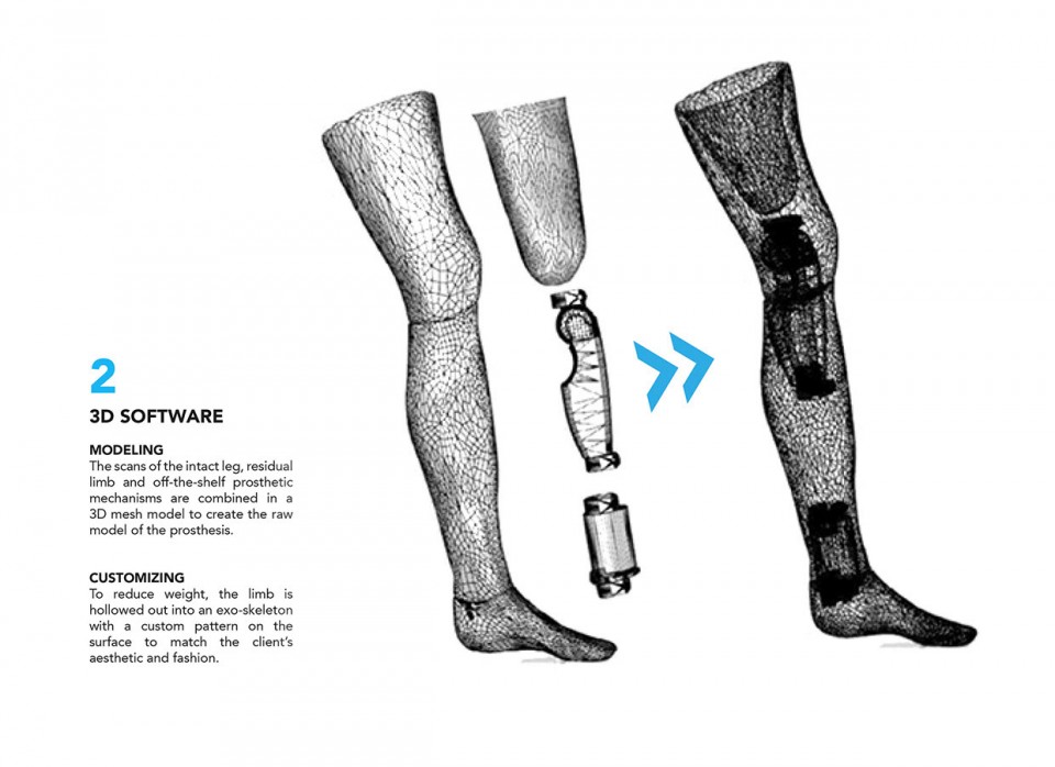 Exo-Prosthetics: Light, Cheap & Custom 3D-Printed Body Parts | Urbanist