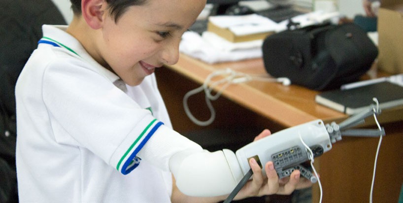 Lego Limb: Bionic Arm for Kids Makes Prosthetics Playful - WebUrbanist